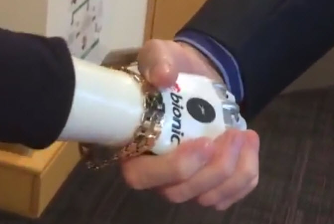 Bionic Prosthetic Hand For The 21st Century - Helpful Colin